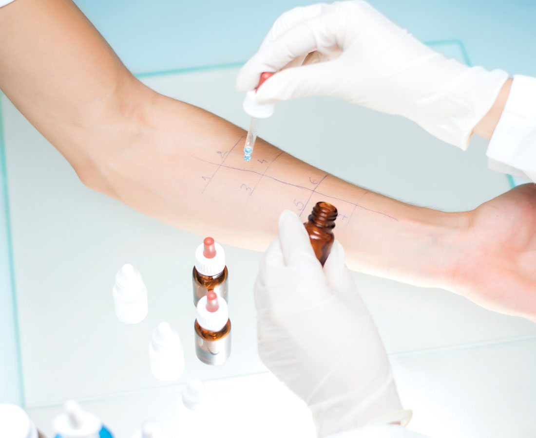 Diagnosing allergies and intolerance - Healthy Food Guide